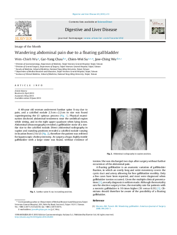 (PDF) Wandering abdominal pain due to a floating gallbladder