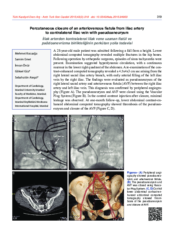 (PDF) Case images: Percutaneous closure of an arteriovenous fistula ...