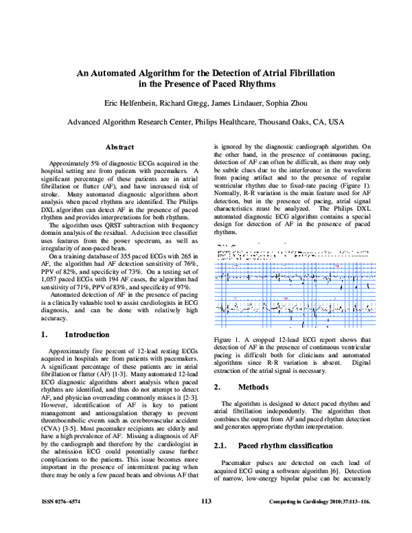 Pdf An Automated Algorithm For The Detection Of Atrial Fibrillation In The Presence Of Paced