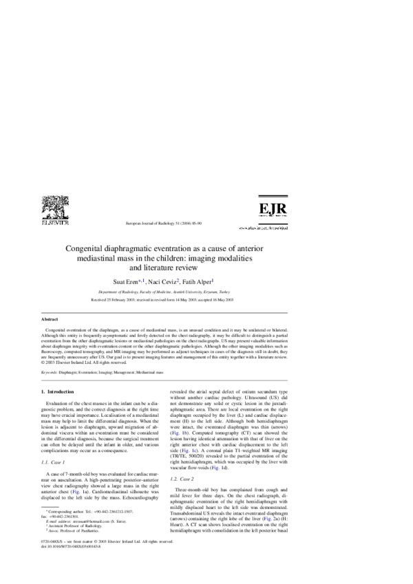 (PDF) Congenital diaphragmatic eventration as a cause of anterior ...