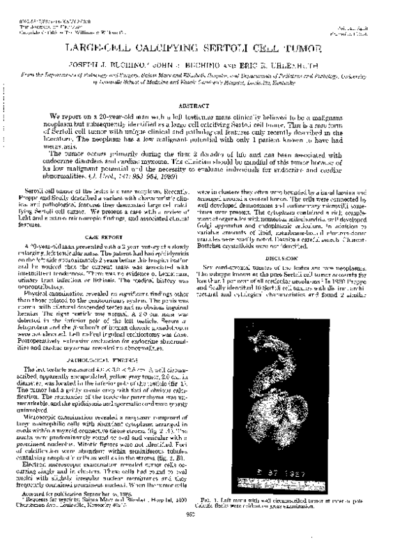 Pdf Large Cell Calcifying Sertoli Cell Tumor