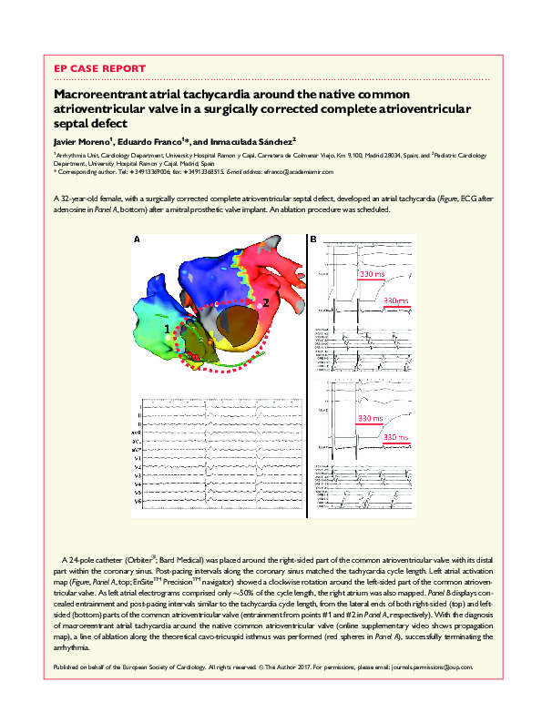 (PDF) Macroreentrant atrial tachycardia around the native common ...