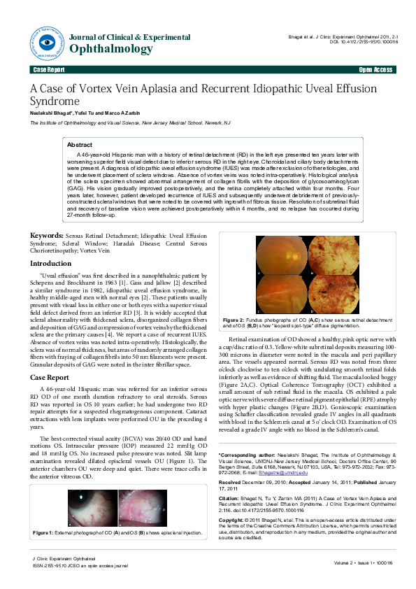 (PDF) A Case of Vortex Vein Aplasia and Recurrent Idiopathic Uveal ...