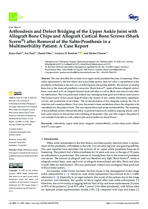 (PDF) Arthrodesis and Defect Bridging of the Upper Ankle Joint with ...