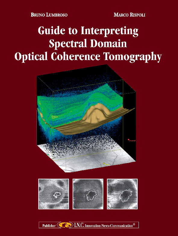 (PDF) Guide to Interpreting Spectral Domain Optical Coherence Tomography