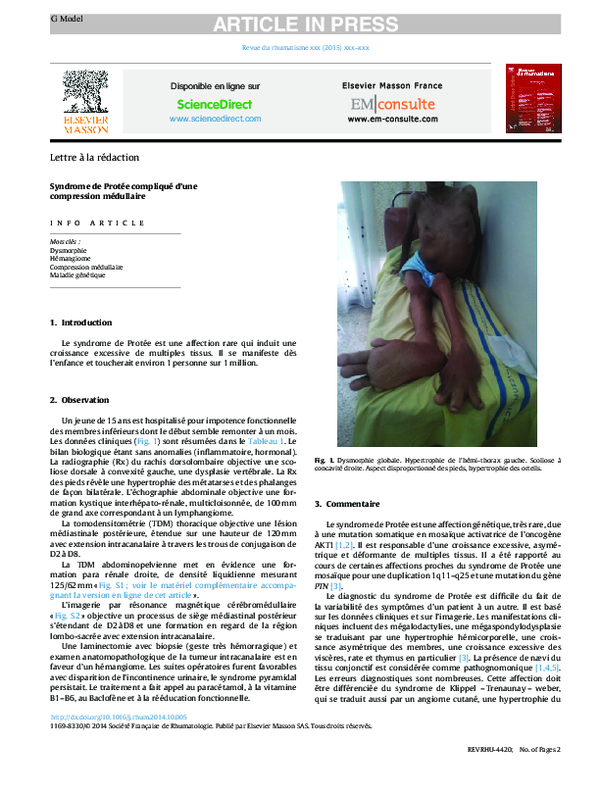 (PDF) Syndrome de Protée compliqué d’une compression médullaire