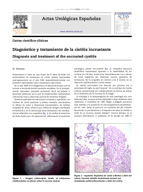 (PDF) Diagnóstico y tratamiento de la cistitis incrustante