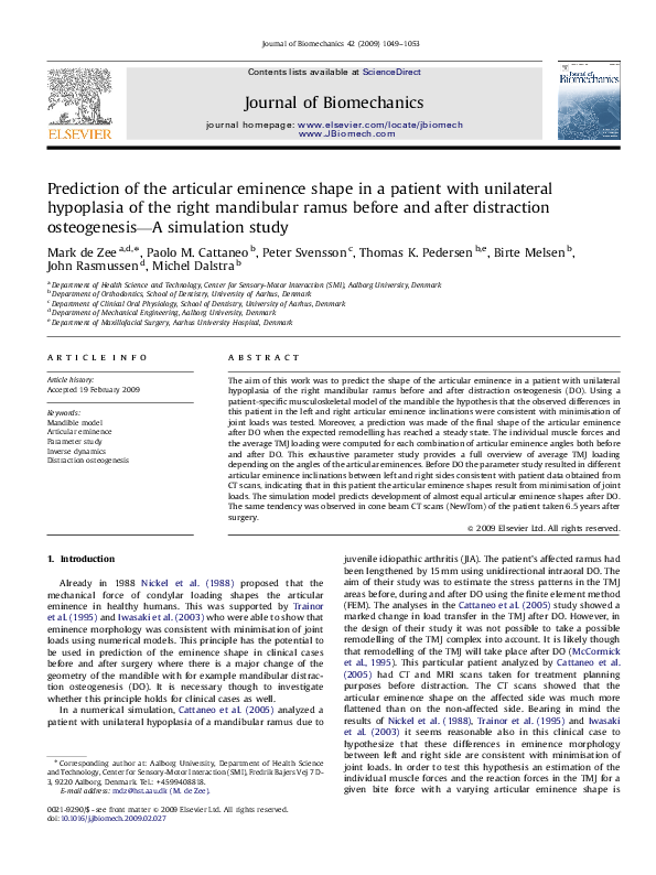 (PDF) Prediction of the articular eminence shape in a patient with ...