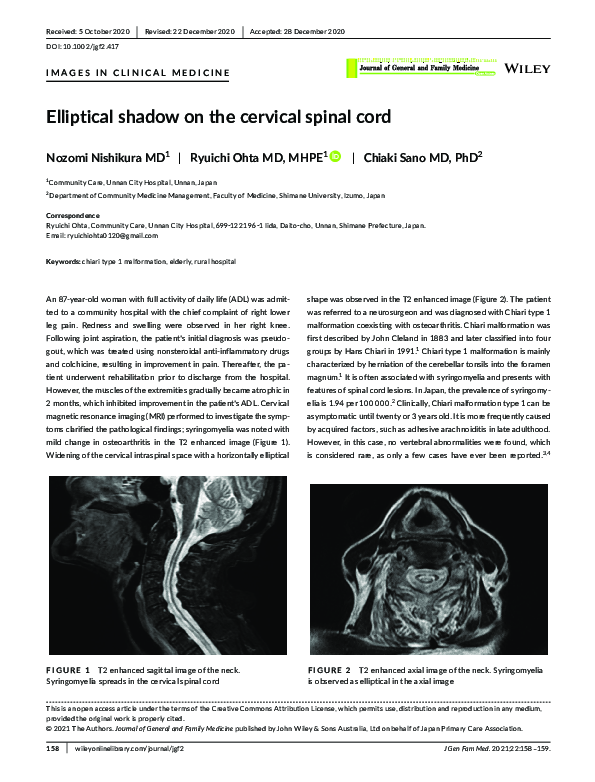 (PDF) Elliptical shadow on the cervical spinal cord | Nozomi Nishikura ...