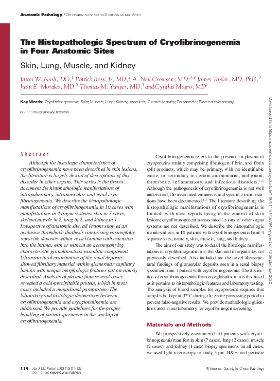 (PDF) The Histopathologic Spectrum of Cryofibrinogenemia in Four ...