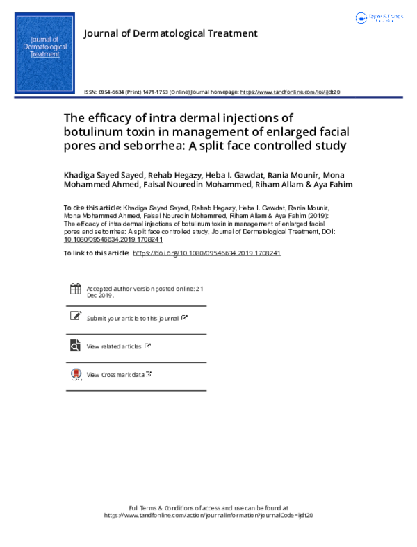 (PDF) The efficacy of intradermal injections of botulinum toxin in the ...