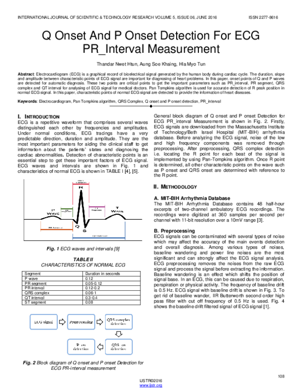 (PDF) Q and P Wave Detection in ECG Analysis