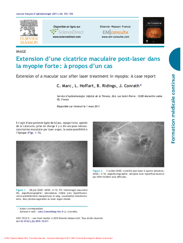 (PDF) Extension d’une cicatrice maculaire post-laser dans la myopie ...