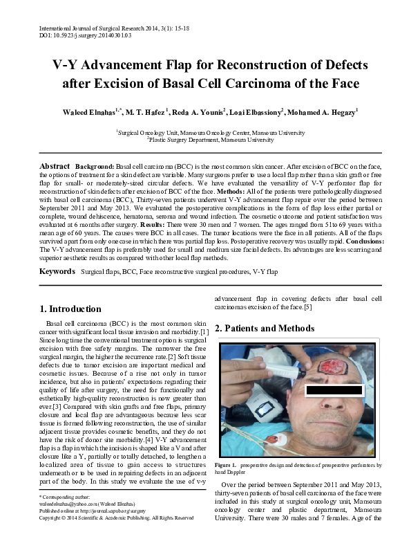 (PDF) V-Y Advancement Flap for Reconstruction of Defects after Excision ...