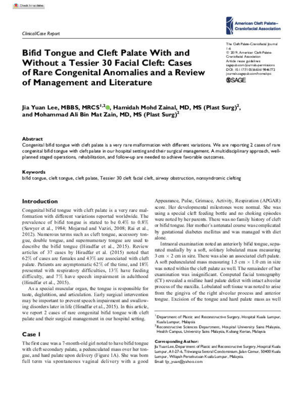 (PDF) Bifid Tongue and Cleft Palate With and Without a Tessier 30 ...