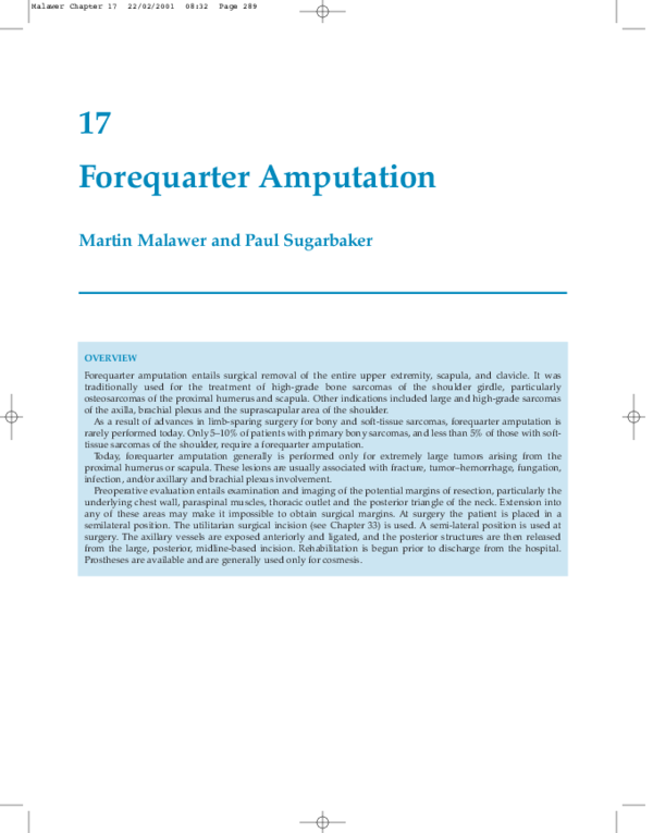 (PDF) 17 Forequarter Amputation