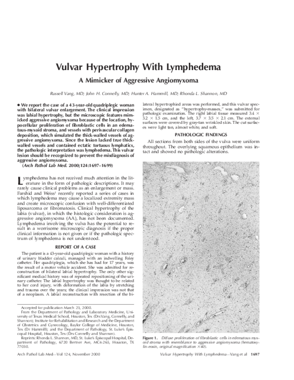(PDF) Vulvar Hypertrophy With Lymphedema