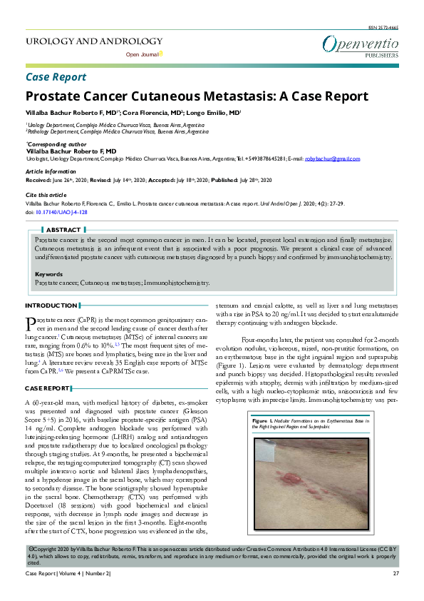 (PDF) Prostate Cancer Cutaneous Metastasis: A Case Report