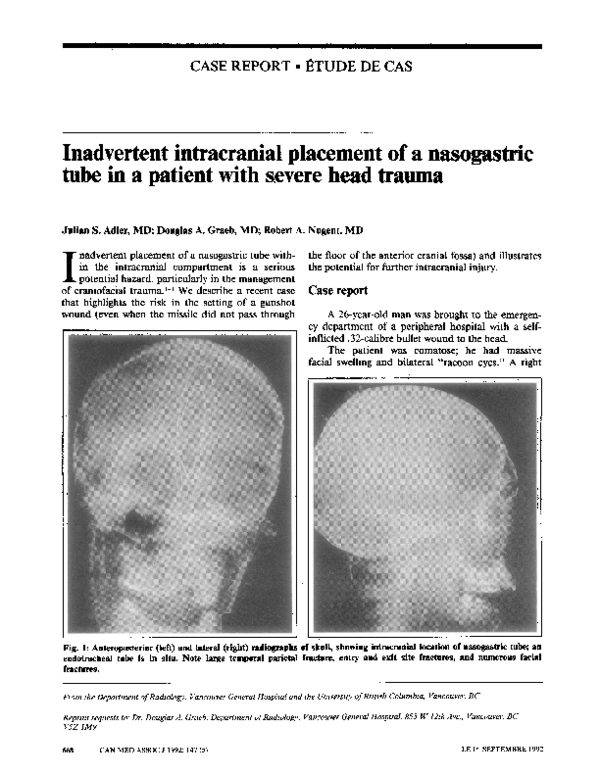 (PDF) Inadvertent intracranial placement of a nasogastric tube in a ...