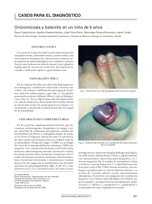 (PDF) Onicomicosis y balanitis en un niño de 5 años