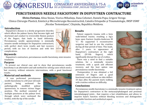 (PDF) Percutaneous needle fasciotomy in Dupuytren contracture