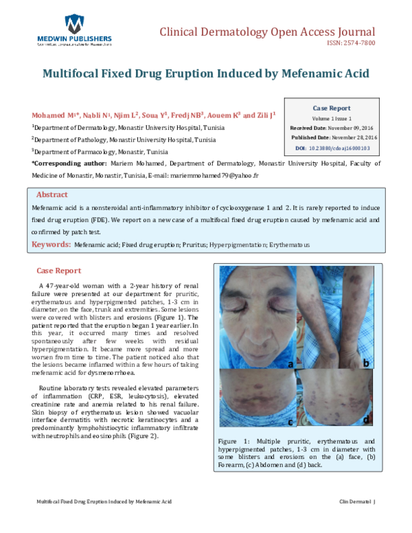 (PDF) Multifocal Fixed Drug Eruption Induced by Mefenamic Acid