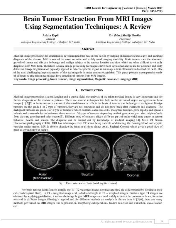 (PDF) Brain Tumour Extration From MR Images Using Segmentation Techniques : A Review