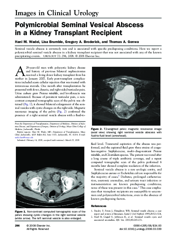 (PDF) Polymicrobial Seminal Vesical Abscess in a Kidney Transplant ...
