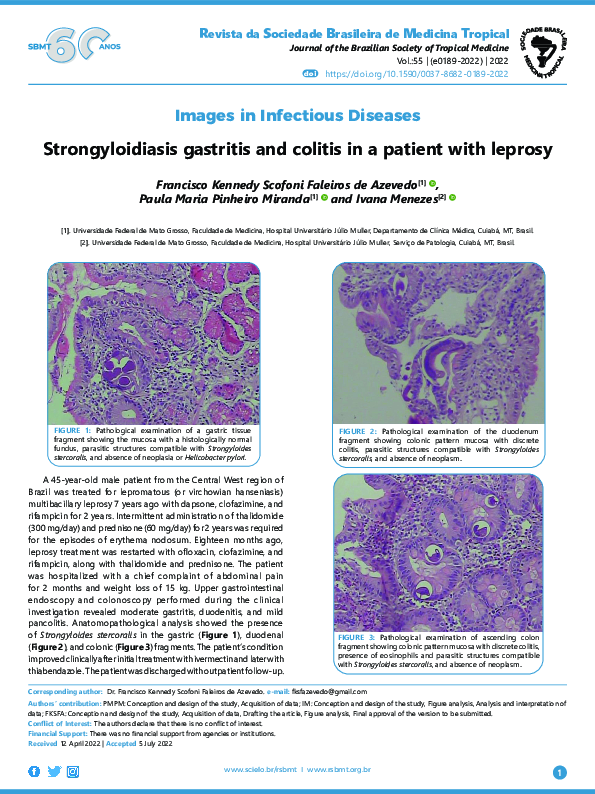 (PDF) Strongyloidiasis gastritis and colitis in a patient with leprosy
