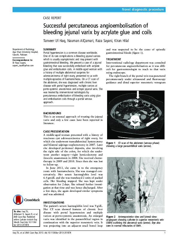 (PDF) Successful percutaneous angioembolisation of bleeding jejunal ...