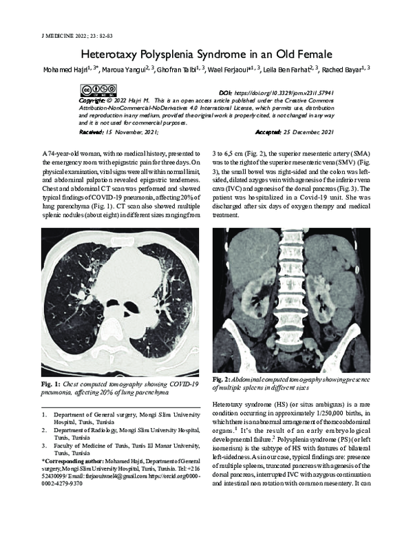 (PDF) Heterotaxy Polysplenia Syndrome in an Old Female