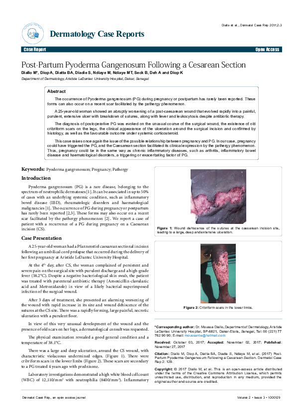(PDF) Post-Partum Pyoderma Gangenosum Following a Cesarean Section