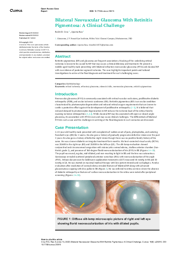 (PDF) Bilateral Neovascular Glaucoma With Retinitis Pigmentosa: A ...