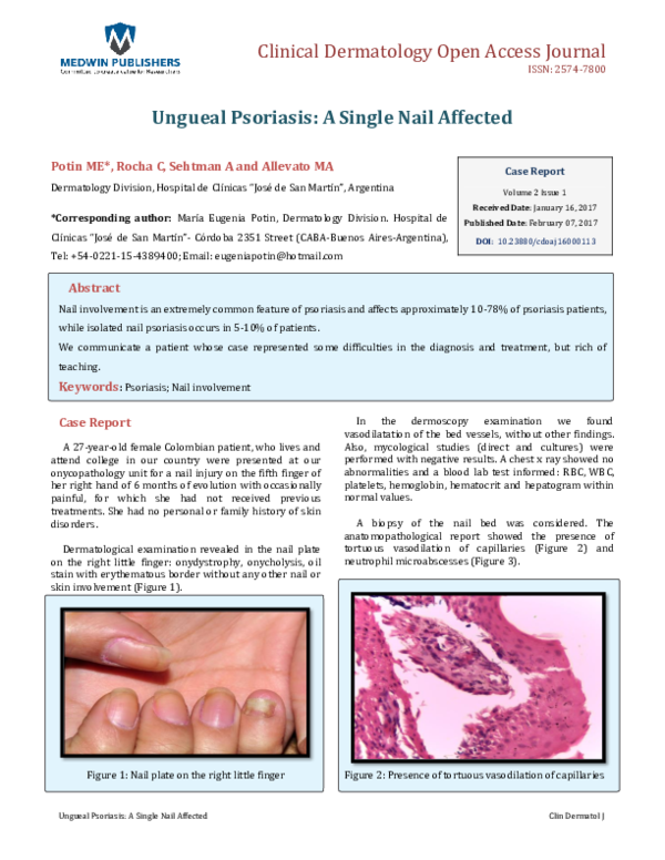 (PDF) Ungueal Psoriasis: A Single Nail Affected