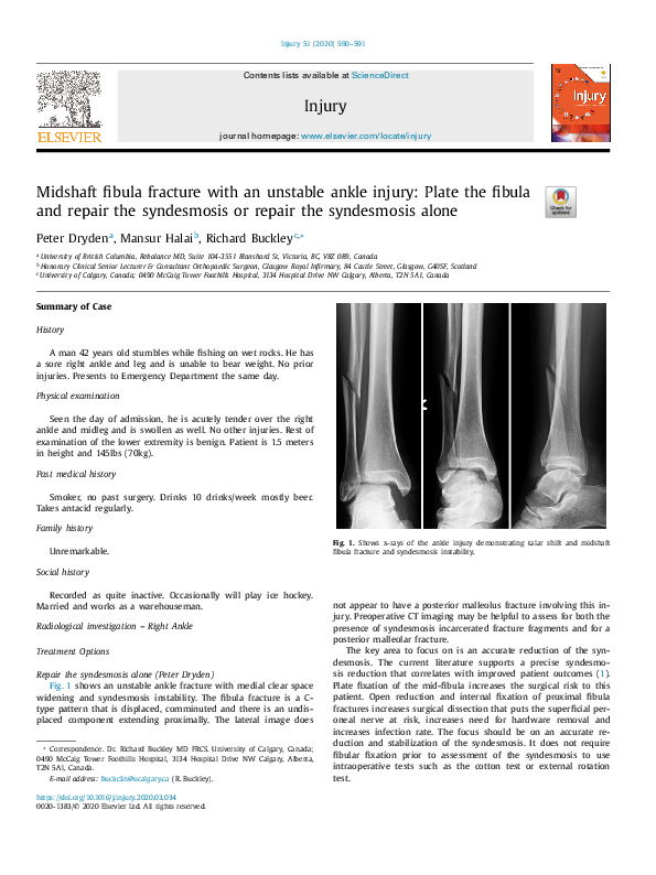 (PDF) Midshaft fibula fracture with an unstable ankle injury: Plate the ...