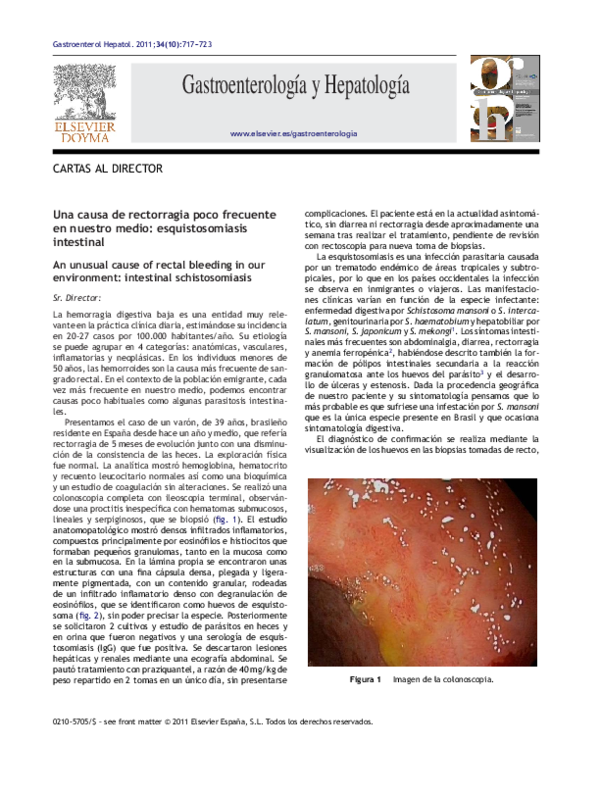 (PDF) Una causa de rectorragia poco frecuente en nuestro medio ...