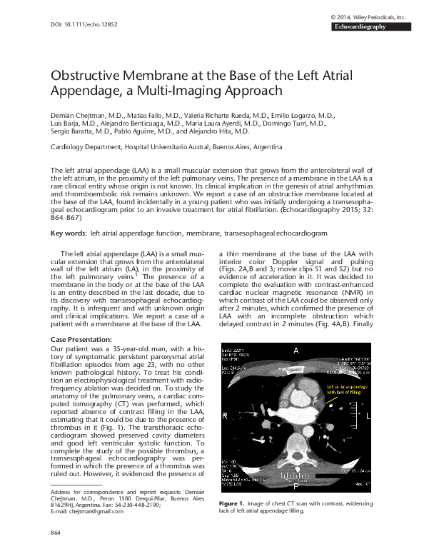 (PDF) Obstructive Membrane at the Base of the Left Atrial Appendage, a ...
