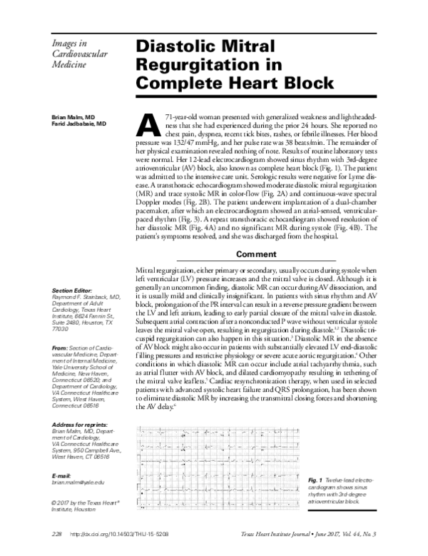 (PDF) Diastolic Mitral Regurgitation in Complete Heart Block