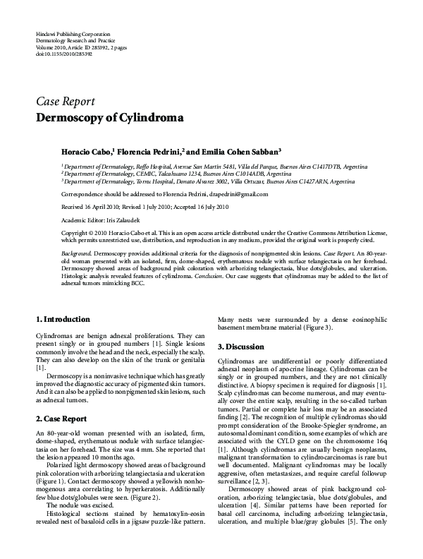 (PDF) Dermoscopy of Cylindroma