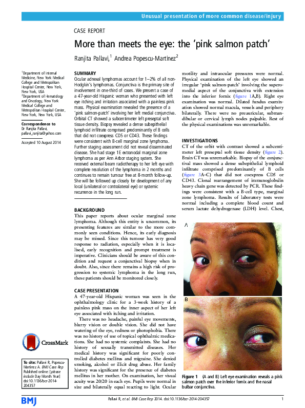 (PDF) More than meets the eye: the 'pink salmon patch