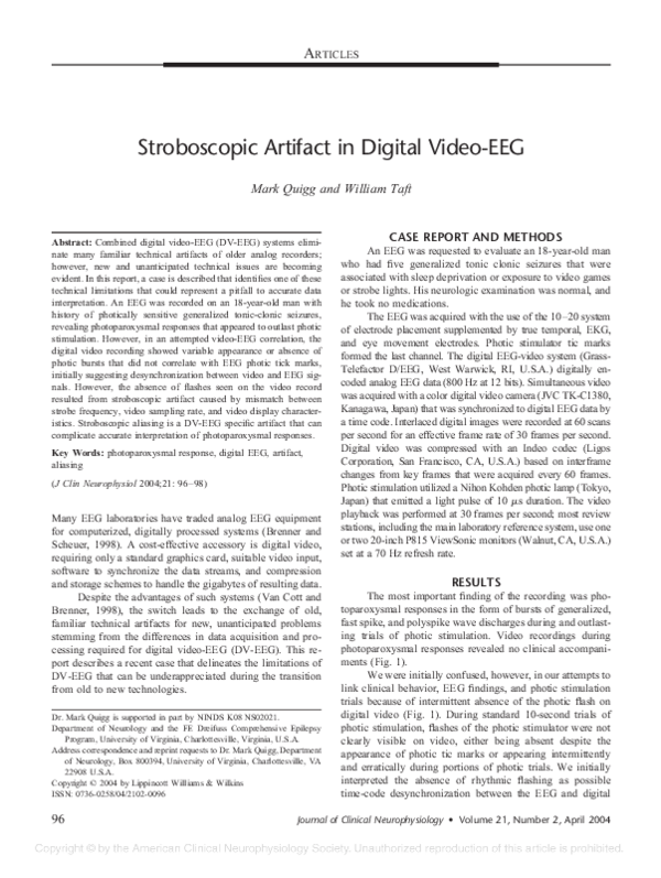 (PDF) Stroboscopic Artifact in Digital Video-EEG