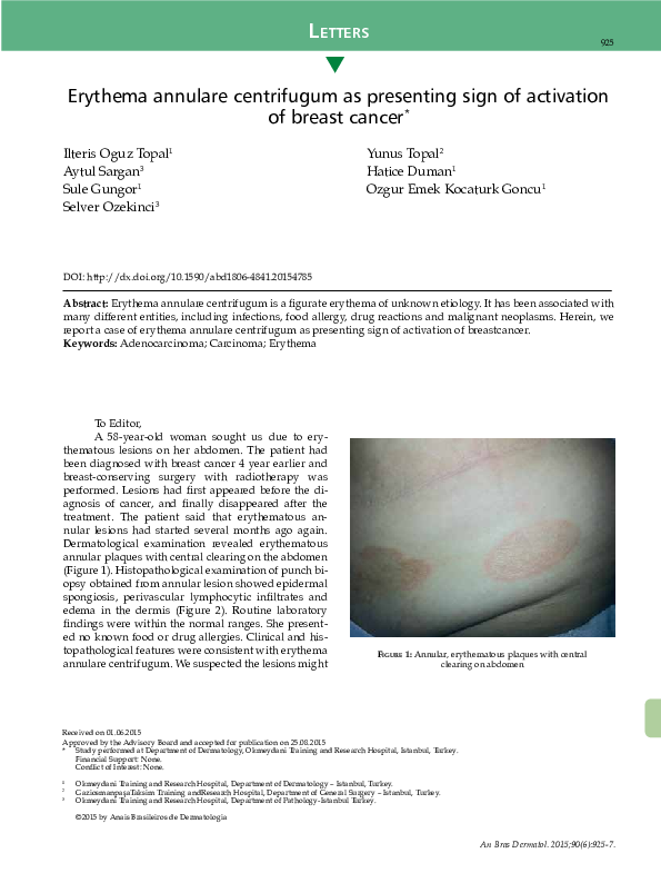(PDF) Erythema annulare centrifugum as the presenting sign of ...