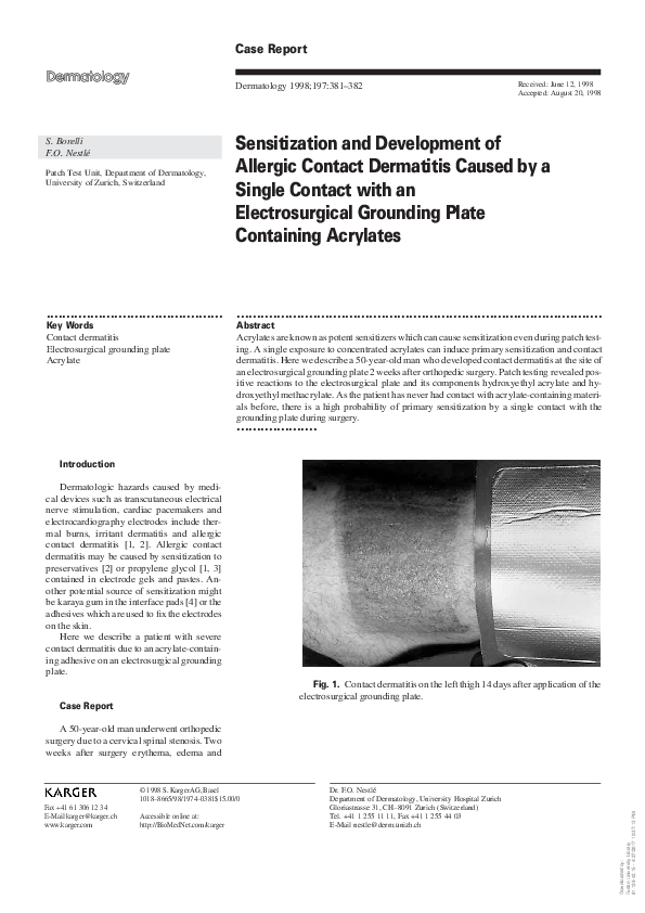 (PDF) Sensitization and Development of Allergic Contact Dermatitis ...