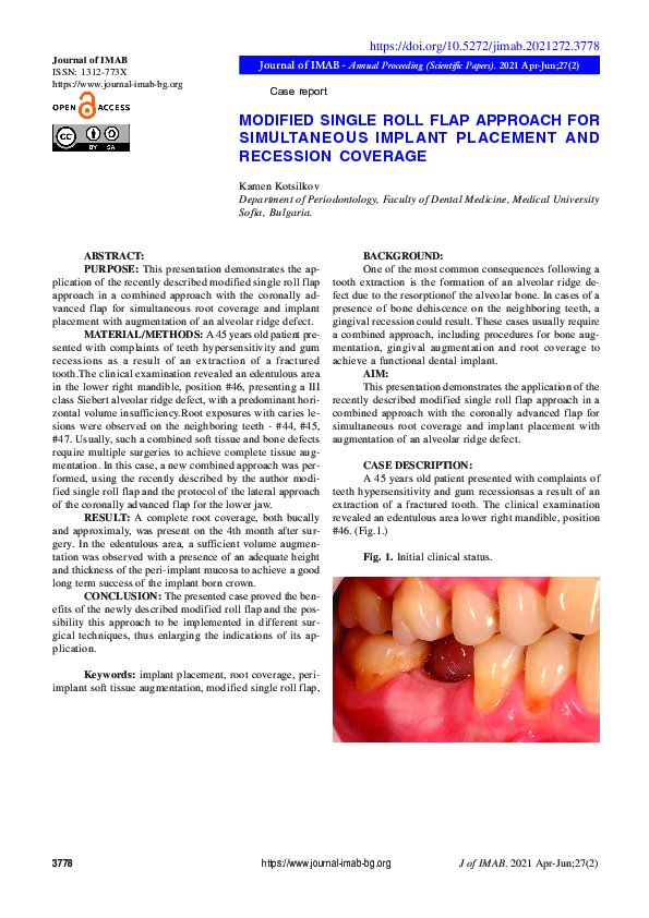 (PDF) Modified Single Roll Flap Approach for Simultaneous Implant ...
