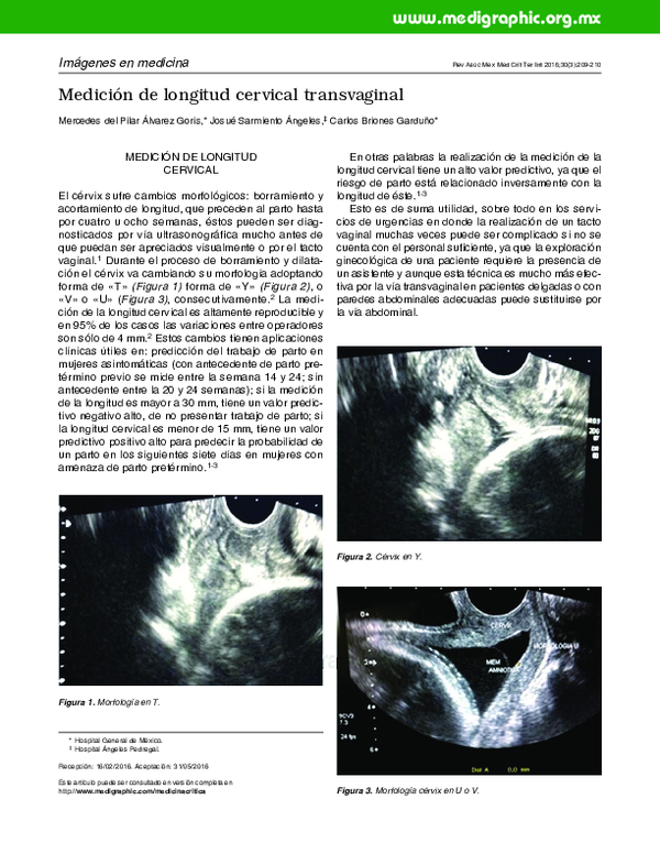 (PDF) Medición de longitud cervical transvaginal