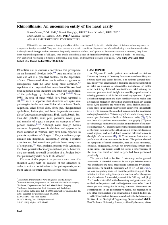 (PDF) Rhinolithiasis: An uncommon entity of the nasal cavity
