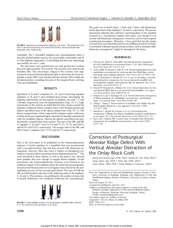 (PDF) Correction of Postsurgical Alveolar Ridge Defect With Vertical ...