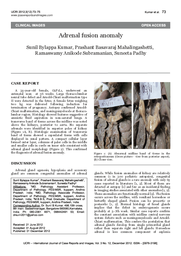 (PDF) Adrenal fusion anomaly