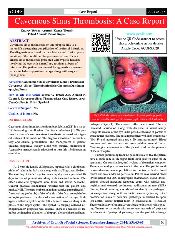 (PDF) Cavernous Sinus Thrombosis : A Case Report | Arunesh Tiwari ...