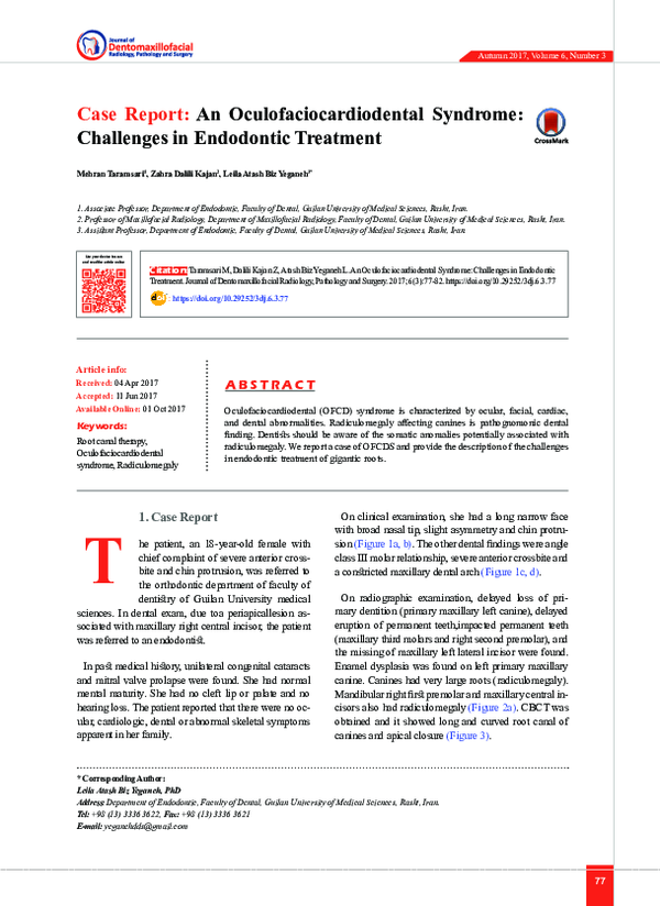 (PDF) An Oculofaciocardiodental Syndrome: Challenges in Endodontic ...